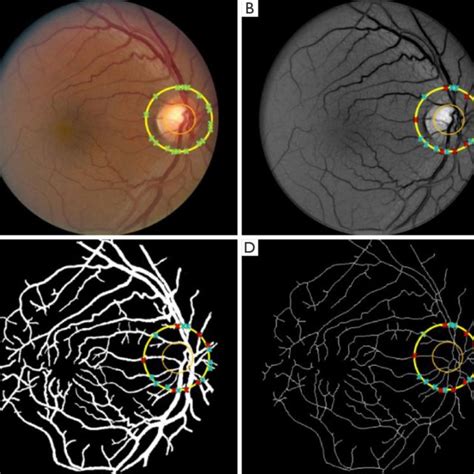 pdf differential artery vein analysis in quantitative retinal imaging