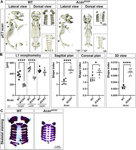 Aggrecan Governs Intervertebral Discs Development By Providing Critical