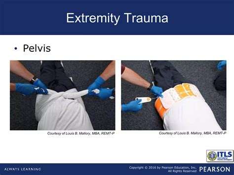 Chapter14 Extremity Trauma Ppt