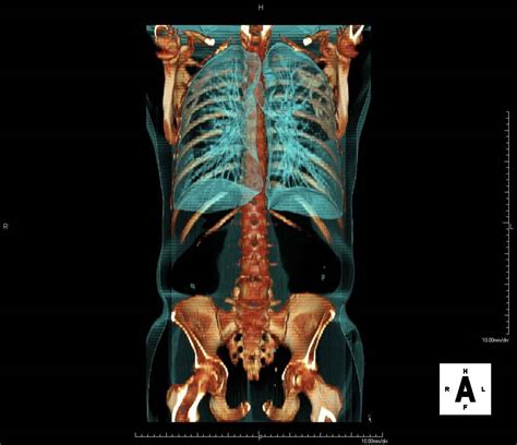 Princeton Longevity Center Full Body Scan Virtual Physical