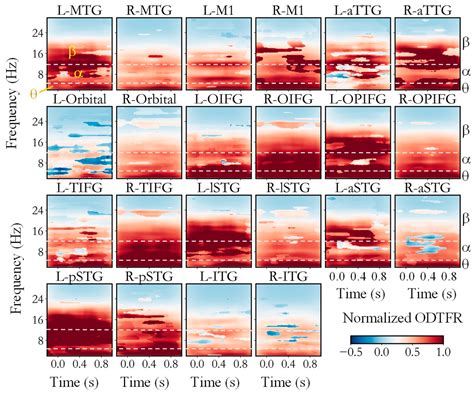 Parameterization Of The Differences In Neural Oscillations Recorded By