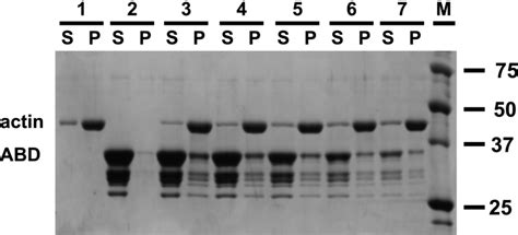 Abd Binding To Filamentous Actin Filamentous Rabbit Skeletal Muscle Download Scientific