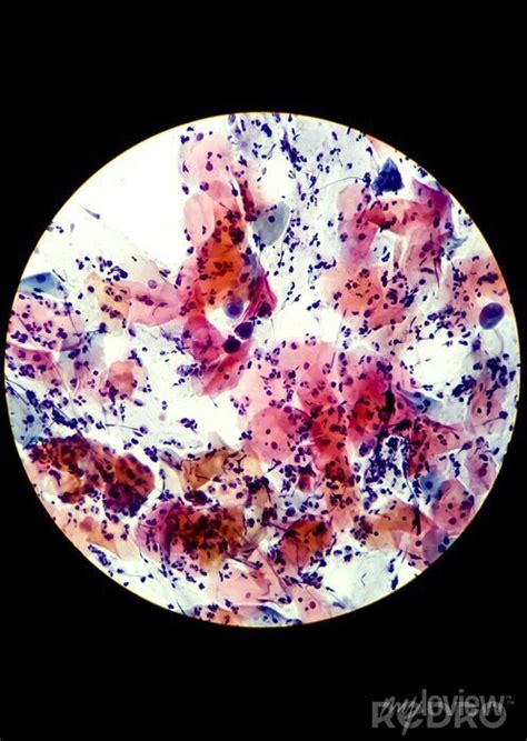 Normal Squamous Epithelial Cells Of Cervical Human View In Microscopy