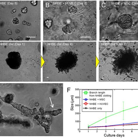 Comparison Of Lung Airway Morphogenesis In 3d Culture A Phase