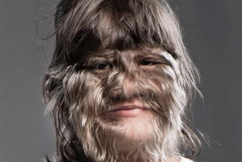 Evo Kako Danas Izgleda Najdlakavija Devojčica Na Svetu Žena Rs