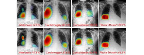 The Saliency Relevance Evaluation Of A Commercially Available Ai