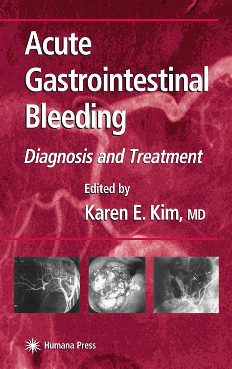Acute Gastrointestinal Bleeding Mehul Traders