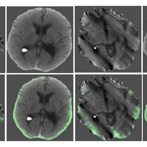 Visualization Of False Positive Predictions Which Are Suppressed By The Download Scientific