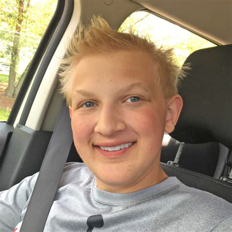 Diagnosed Over The Phone With Ectodermal Dysplasia Nfed