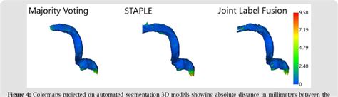 Figure 1 From Automated Segmentation Of The Sigmoid Sinus Using A Multi Atlas Approach