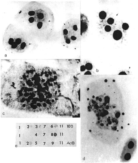 A E A H Nucleoli Of Interphase Nuclei After Silver Staining A With 4 Download Scientific