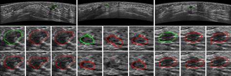 Figure 1 From Residual Swin Transformer Unet With Consistency Regularization For Automatic