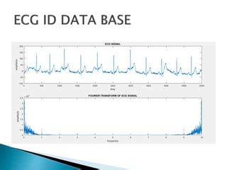 ECG SIGNAL GENERATED FROM DATA BASE USING MATLAB PPTX Heart And Cardiovascular Diseases