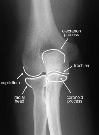 Elbow Xray Anatomy Radiopaedia