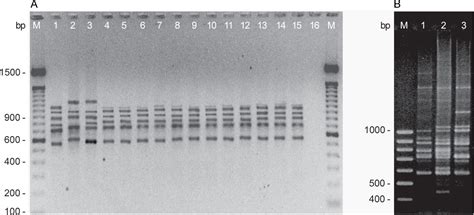 Figure 1 From Application Of Pcr Ribotyping And Tdna Pcr For Klebsiella Pneumoniae
