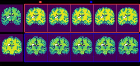 comparisons between different models on ixi dataset download