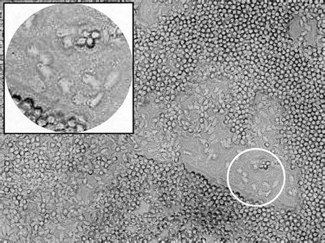 Photomicrograph Of Culture Plate Demonstrating Heavy Growth Of