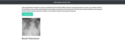 Pneumonia Identification Devpost