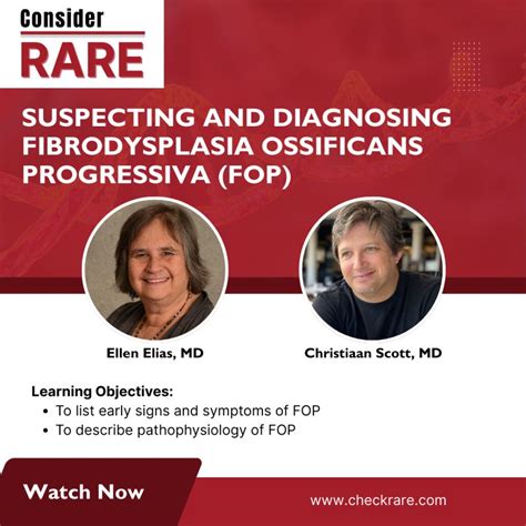 How To Suspect And Diagnose Fop A Rare Condition Checkrare Posted On The Topic Linkedin