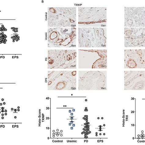 txnip is upregulated in pd patients a txnip expression was analyzed