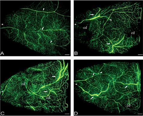 Retinal Fluorescein Angiographies Fags 5× Objective Focused On The Download Scientific