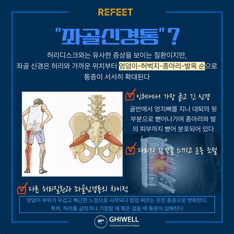 좌골신경통 증상 및 발생위험군 알아보기 Social Media Refeet 리핏