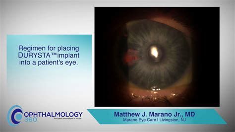 Slit Lamp View Of Durysta Being Delivered To Target Tissues In Patient