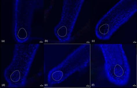 Hair Follicles Staining With DAPI And Identification Of Papilla Dermis Download Scientific