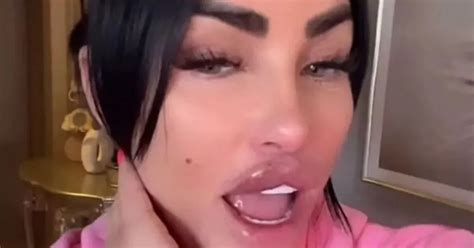 Katie Price Unveils Biggest Lips Ever After Fourth Filler Session In