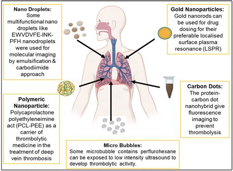 Application Of Nanotechnology In Pulmonary Embolism Nanotechnologies Download Scientific