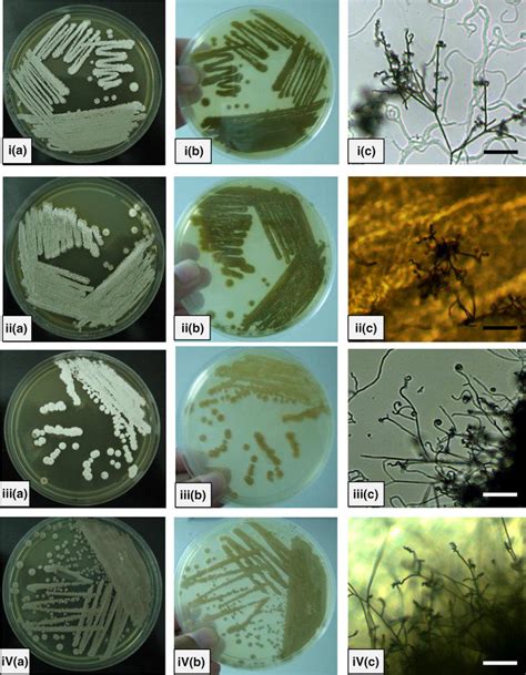 35 Day Old Actinomycete Colonies Growing On Yeast Extract Malt Extract