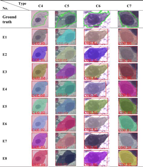 Cell Segmentation Results Of Various Data Augmentation Methods On