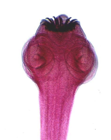 Dipylidium Scolex