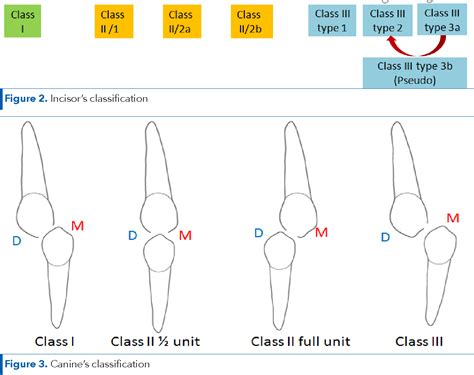 Dental Classification Of Occlusion At Charles Dunaway Blog