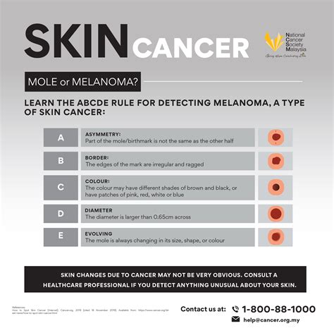 Heres The Abcde Rule National Cancer Society Malaysia