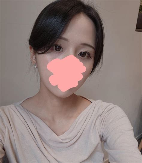 시술 수술 질문 애교필러 맞아볼까요 강남언니 1등 성형수술and피부시술 정보앱