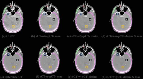 Figure 1 From Synthetic Ct Generation From Cbct Images Via Deep