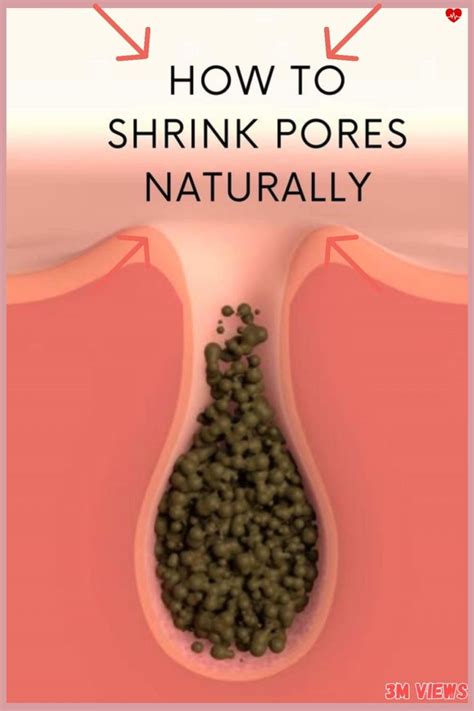 How To Shrink Enlarged Pores Methods You Can Try Artofit
