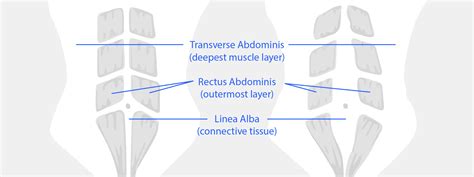Abdominal Separation Diastasis Recti Katys Fitness