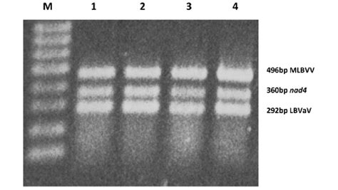 Agarose Gel Resulting From A Multiplex Reverse Transcription Polymerase Download Scientific