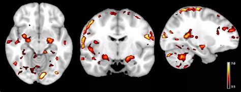 Decoding Spatial Memory Functions Of Hippocampal Subregions