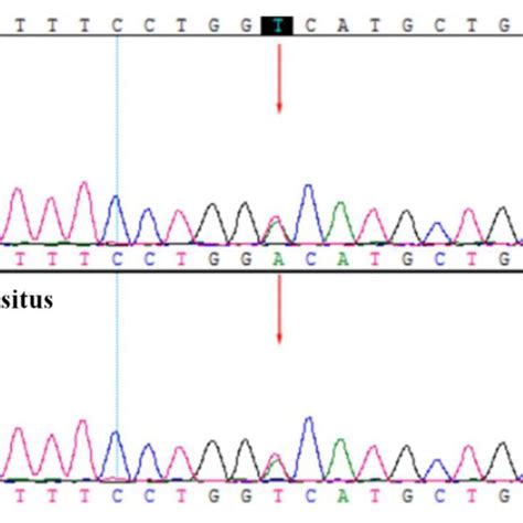 The Whole Exome Sequencing And Sanger Sequencing Verification Showed