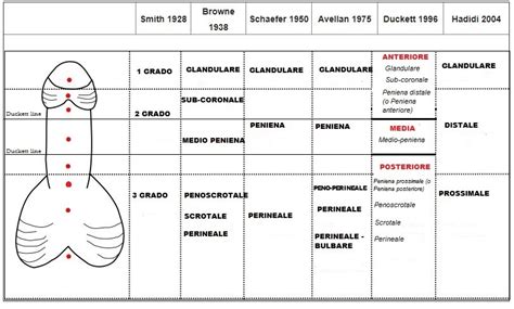Ipospadia Significato Pericoli Ed Intervento