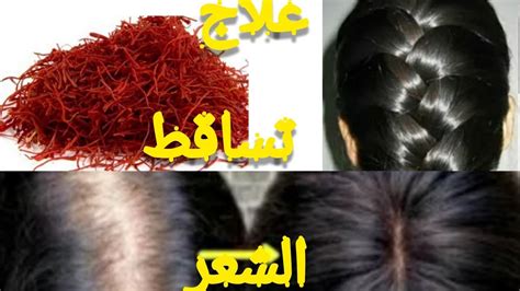 علاج تساقط الشعر وصفة طبيعية تمنع تساقط الشعر وتنبت ليك الشعر واخة