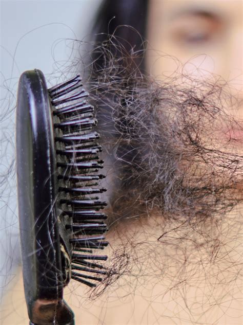 10 Causes Of Excessive Hairfall Health And Me