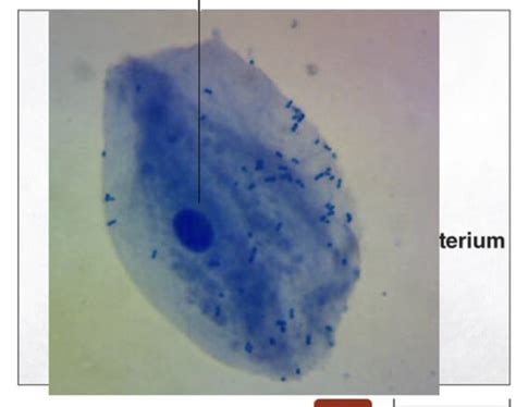 Microscopy Flashcards Quizlet