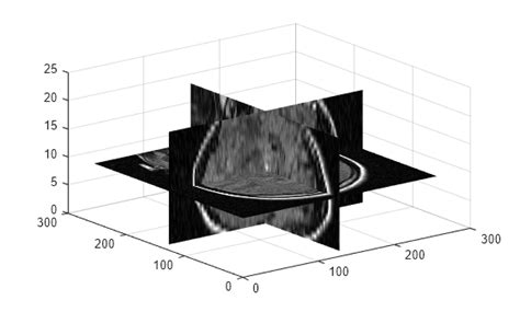 imbinarize binarize 2 d grayscale image or 3 d volume by thresholding matlab