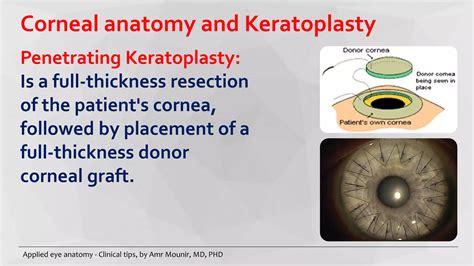 Applied Eye Anatomy Clinical Tips Ppt