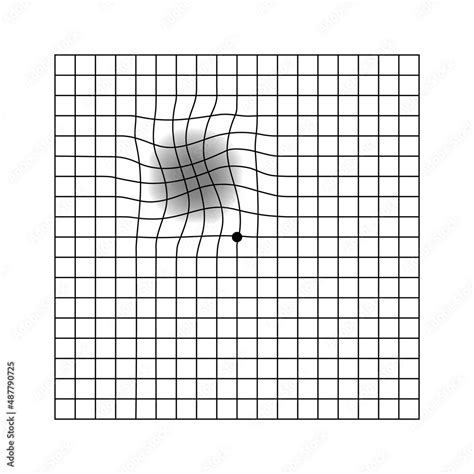 Amsler Eye Scotoma Test Grid Vector Printable Chart Retina Examination