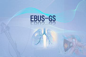 Ebus Tbna